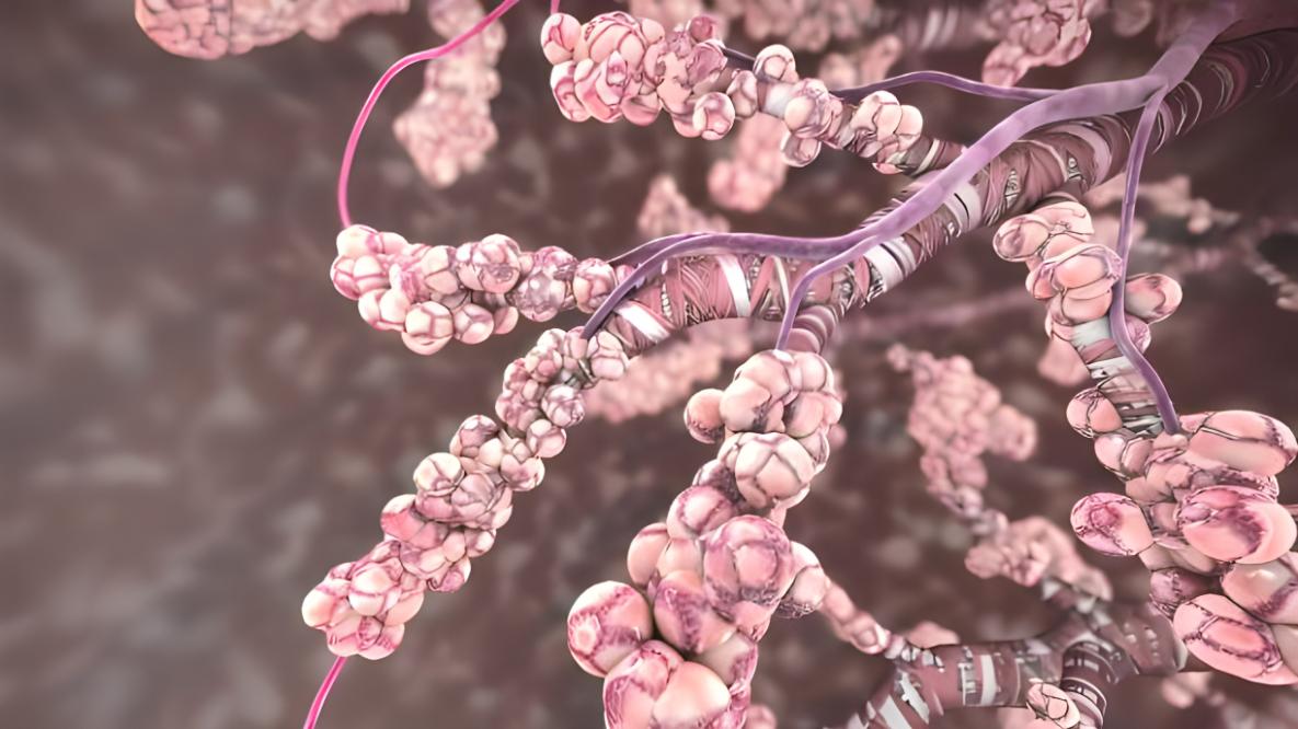 Fibrosis Pulmonar: Síntomas, Causas y Tratamiento